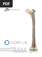 Zimmer Natural Nail System Tibial Nail Surgical Technique | PDF | Screw ...