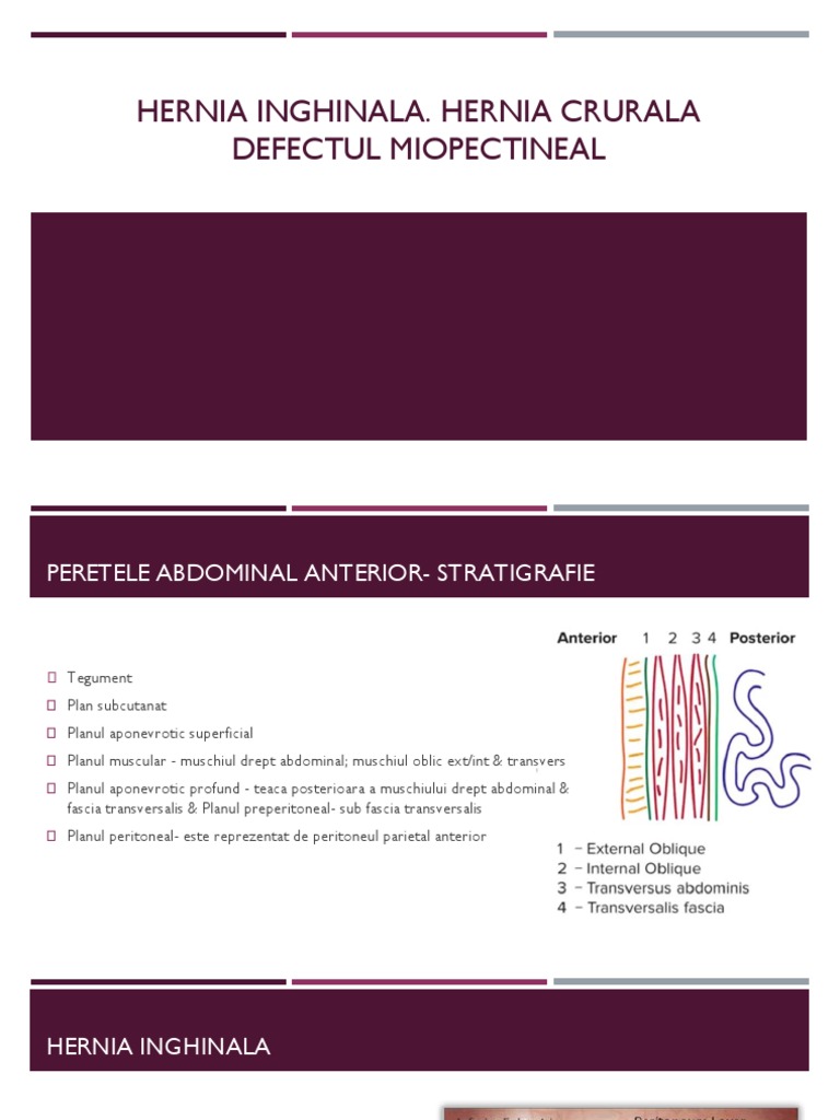 Hernia Inghinala Crurala Si Defectul Miopectineal | PDF