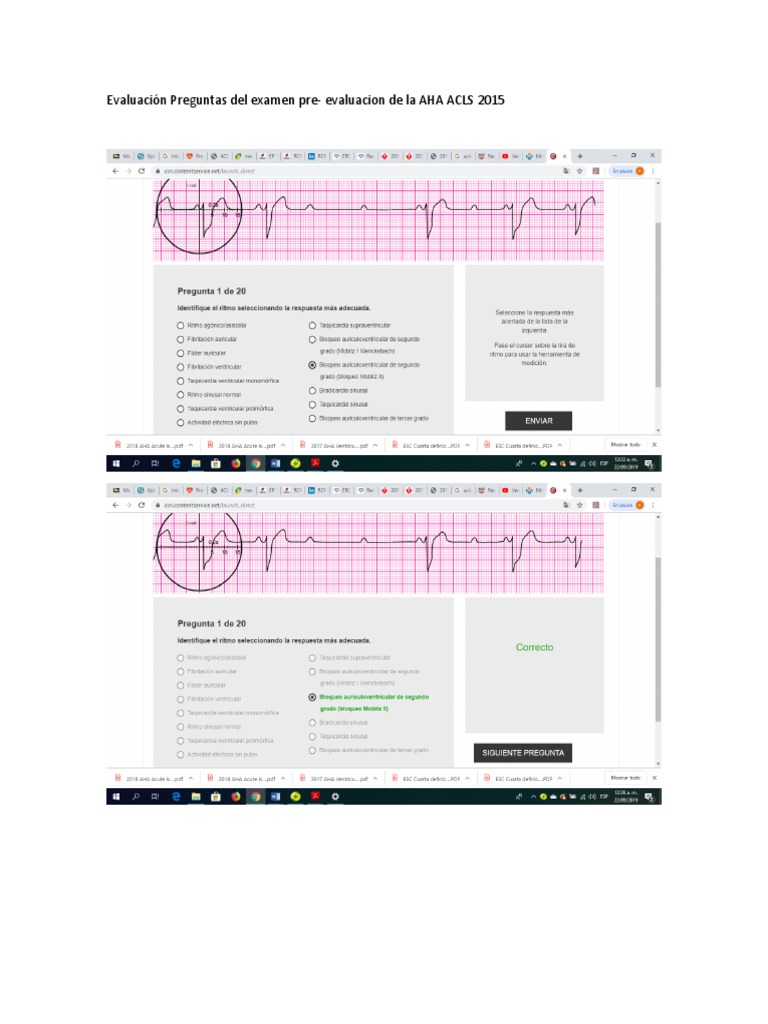 Pre-Evaluacion SVCA ACLS AHA 2015 Con Los Trazados Del EKG y Respuestas | PDF