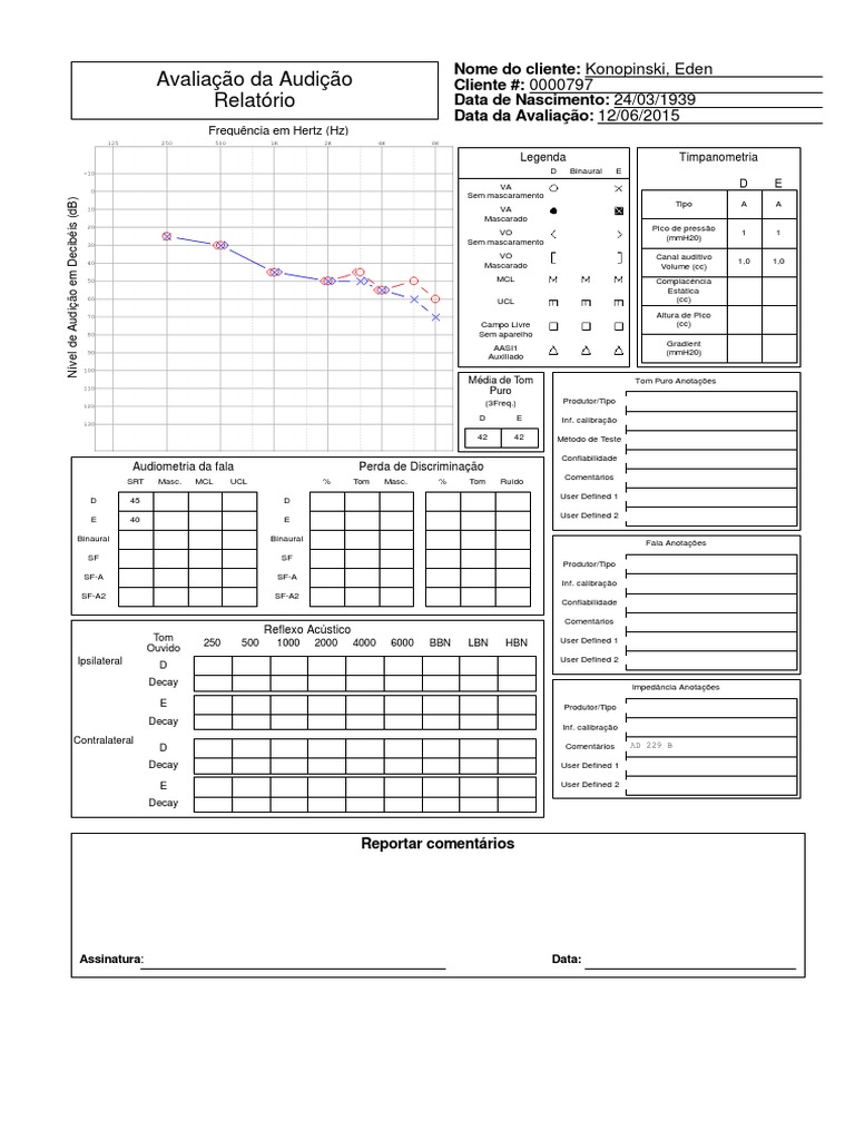 NOAH Audiogram | Download grátis PDF | Audição | Acústica