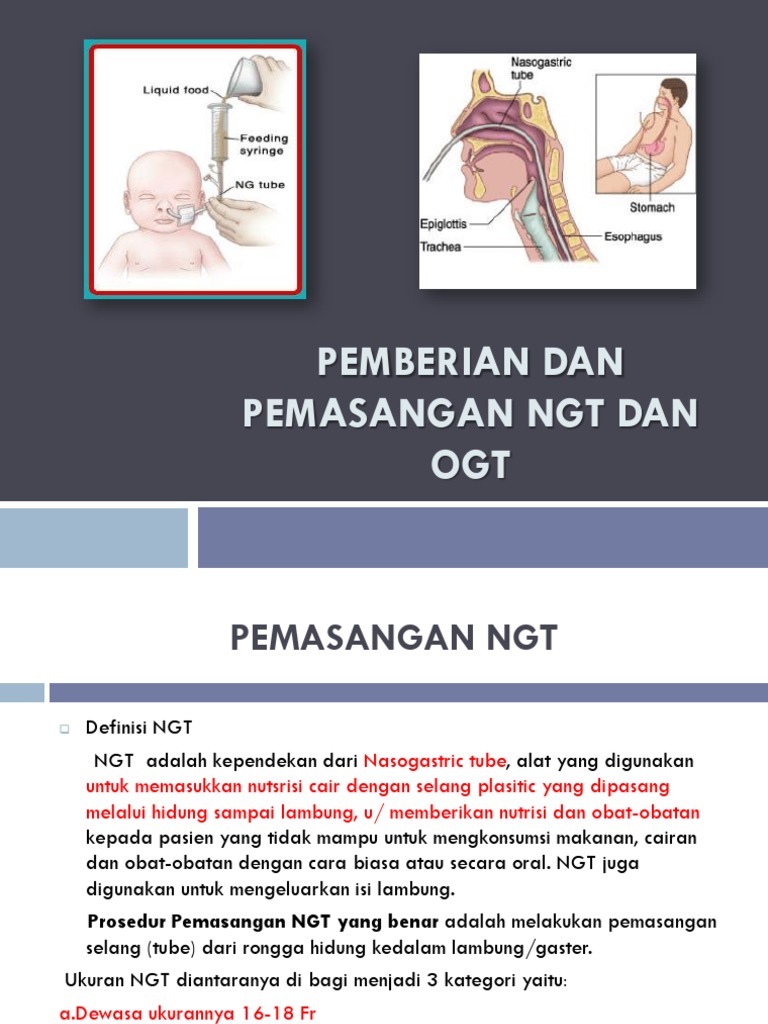 PPT Ogt Dan NGT | PDF