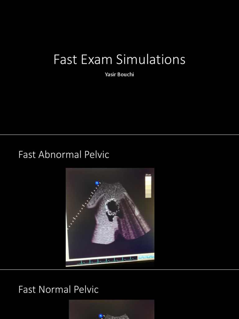 Fast Exam Simulations: Yasir Bouchi | PDF