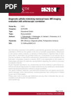 MRI Meniscus Tear Grading Guide | PDF
