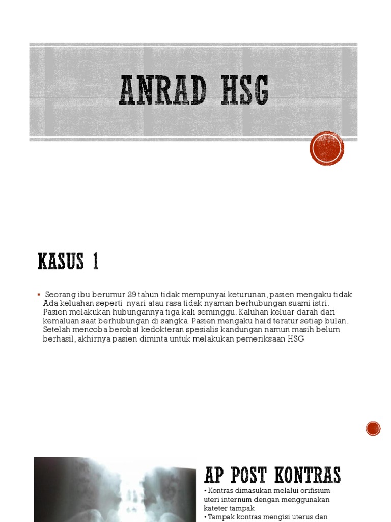 Anatomi Radiografi HSG | PDF