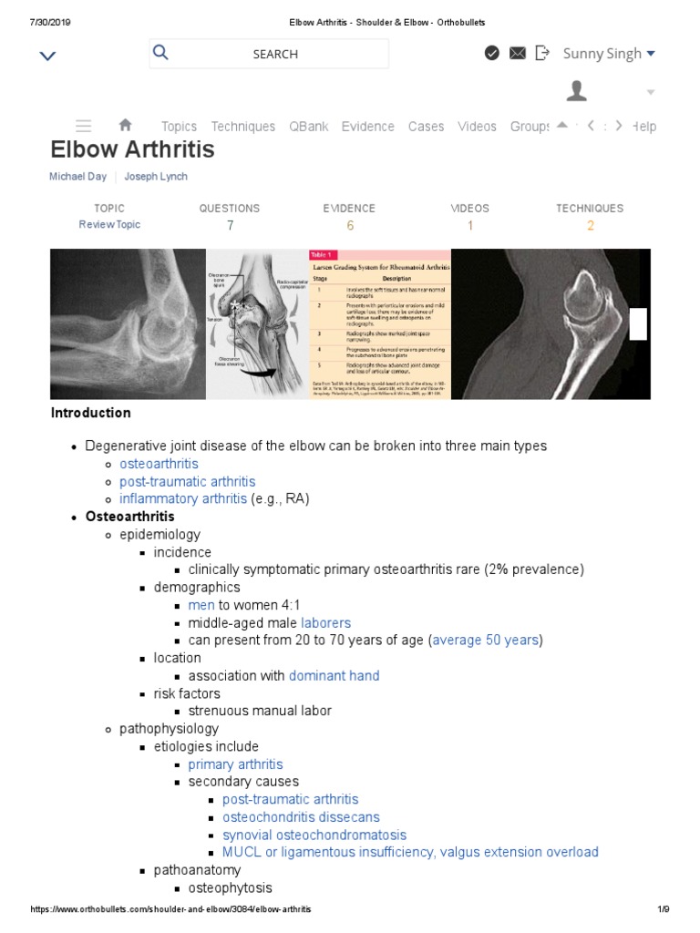 Elbow Arthritis - Shoulder & Elbow - Orthobullets | PDF | Elbow ...