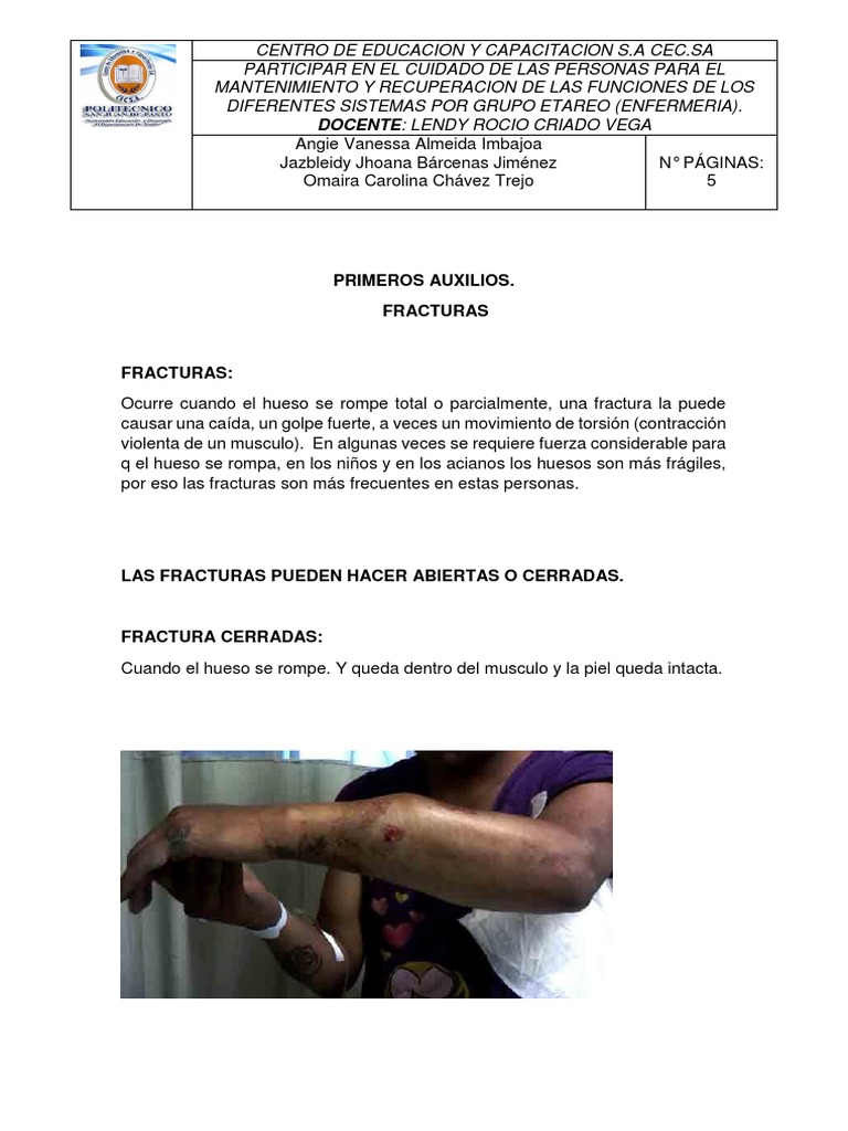 PRIMEROS AUXILIOS FRACTURAS. Plantilla | PDF | Herida | Hueso
