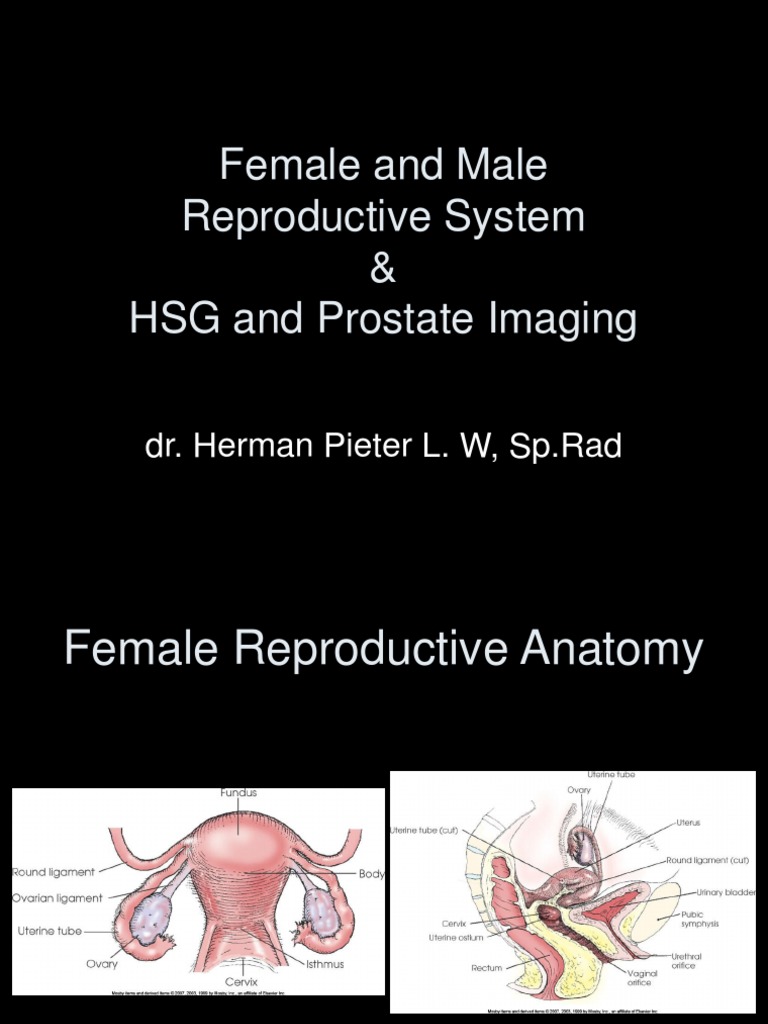 Female and Male Reproductive System & HSG and Prostate Imaging | PDF
