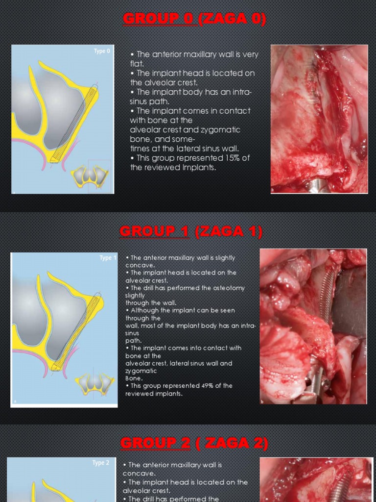 Zaga | PDF | Musculoskeletal System | Skeletal System