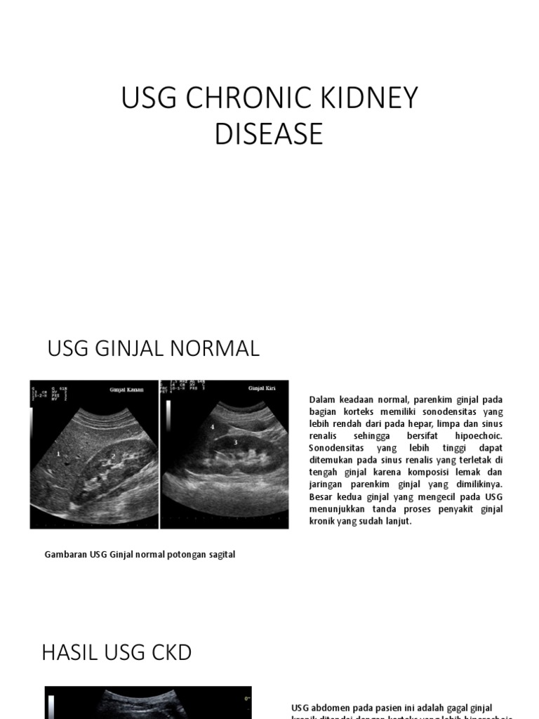 Usg CKD | PDF