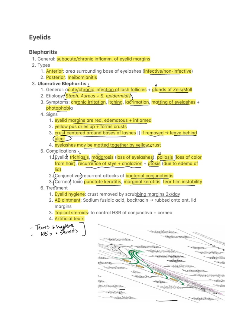 Understanding Common Eyelid Disorders: A Comprehensive Guide to ...
