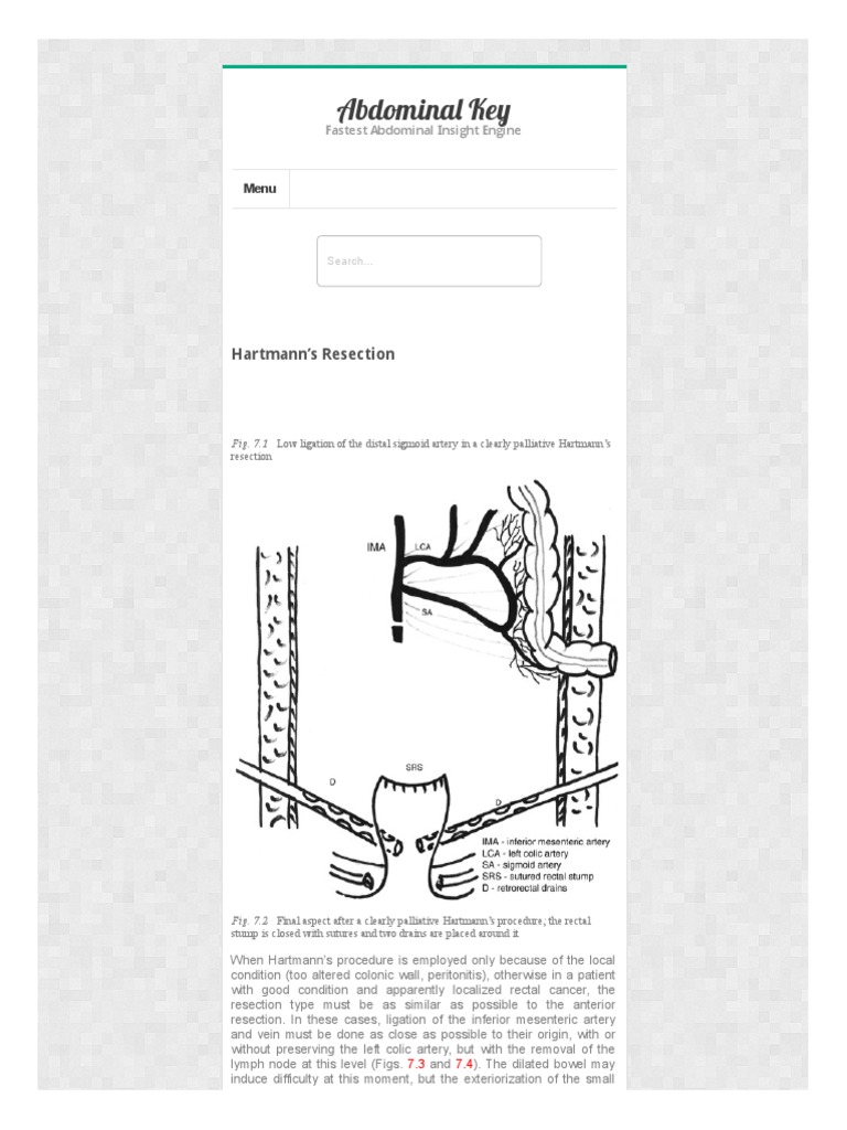 Hartmann’s Resection Overview | PDF | Surgery | Gastroenterology