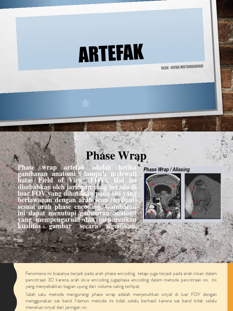Artefak Mri | PDF