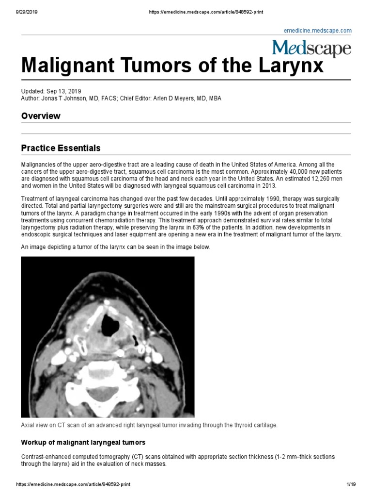 Tumor Laring Medscape | PDF | Larynx | Cancer