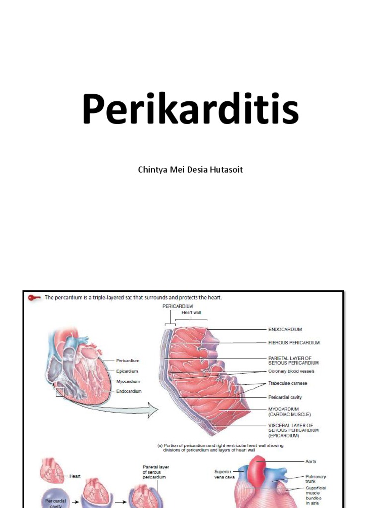Perikarditis | PDF | Medical Specialties | Clinical Medicine