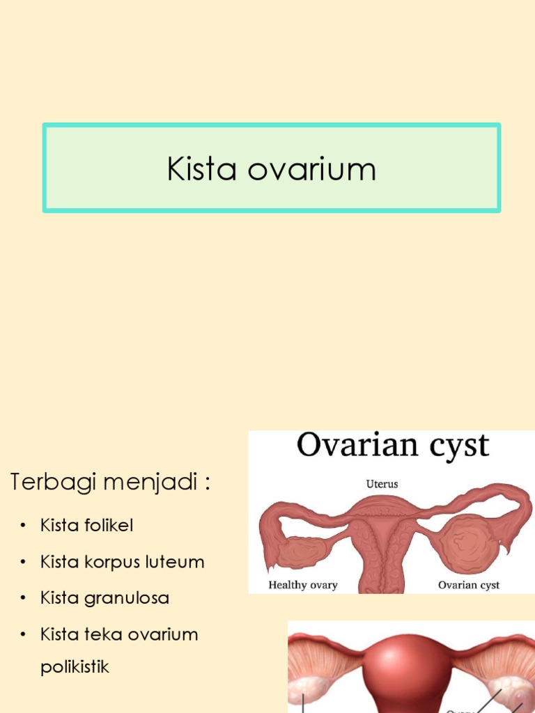 Jenis dan Karakteristik Kista Ovarium | PDF
