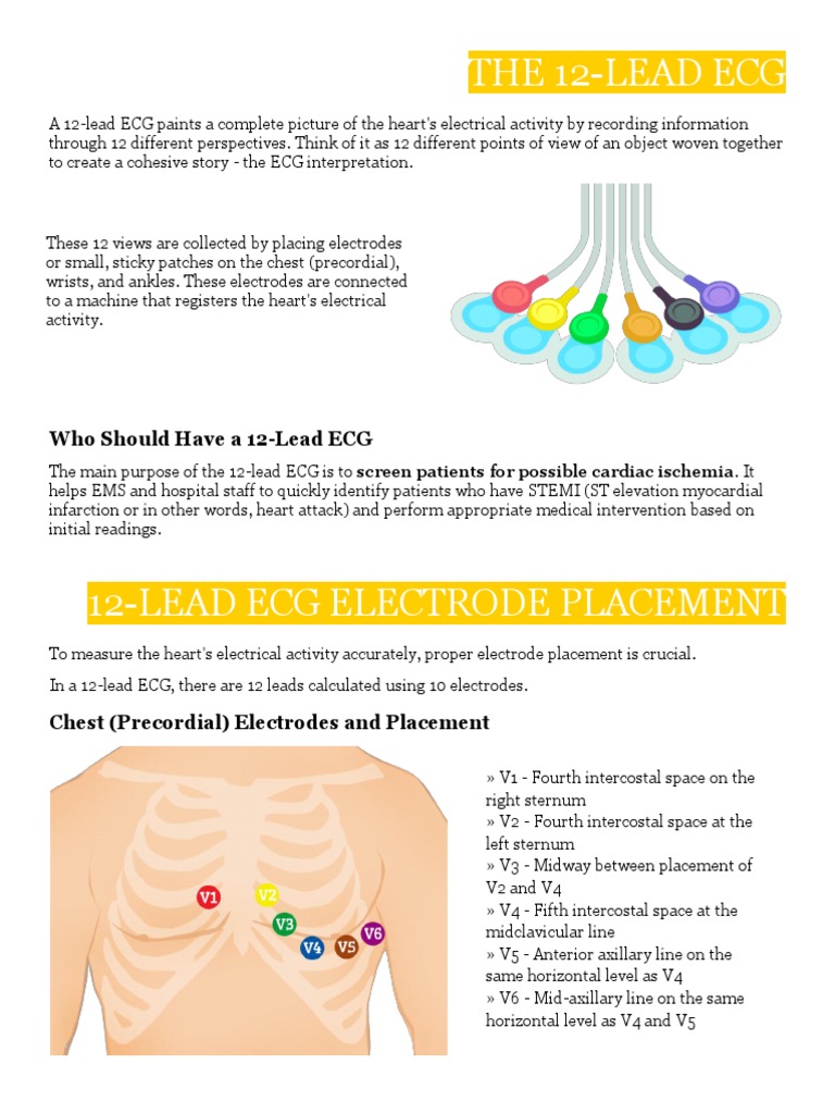 12 Lead Ecg Placements | Electrocardiography | Myocardial Infarction