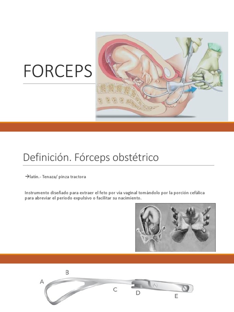 Uso y Clasificación de Fórceps Obstétricos | PDF | Ciencia y matemáticas