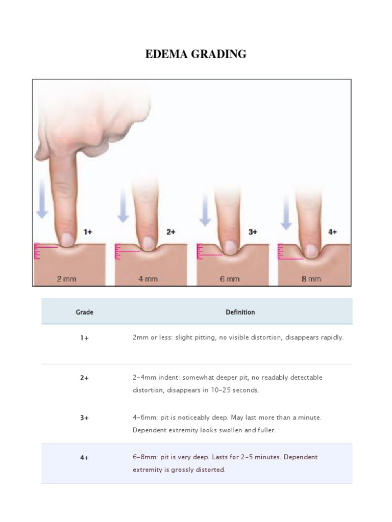 Edema | PDF