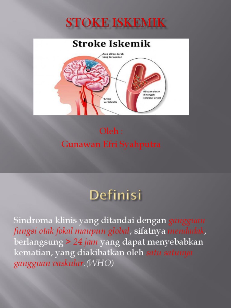 Stroke Iskemik | PDF