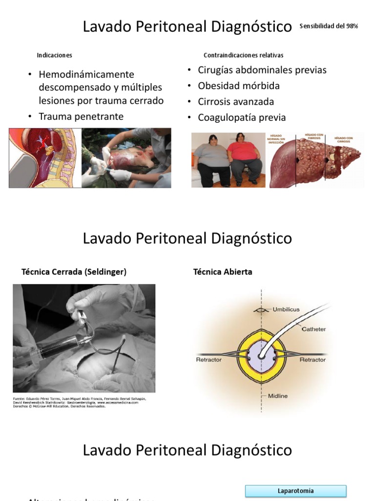 Lavado Peritoneal | PDF | Peritoneo | Abdomen