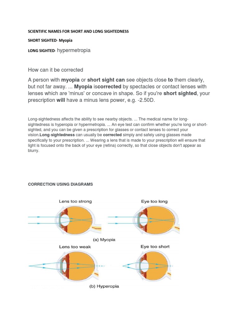 Scientific Names For Short and Long Sightedness Short Sighted-Myopia ...