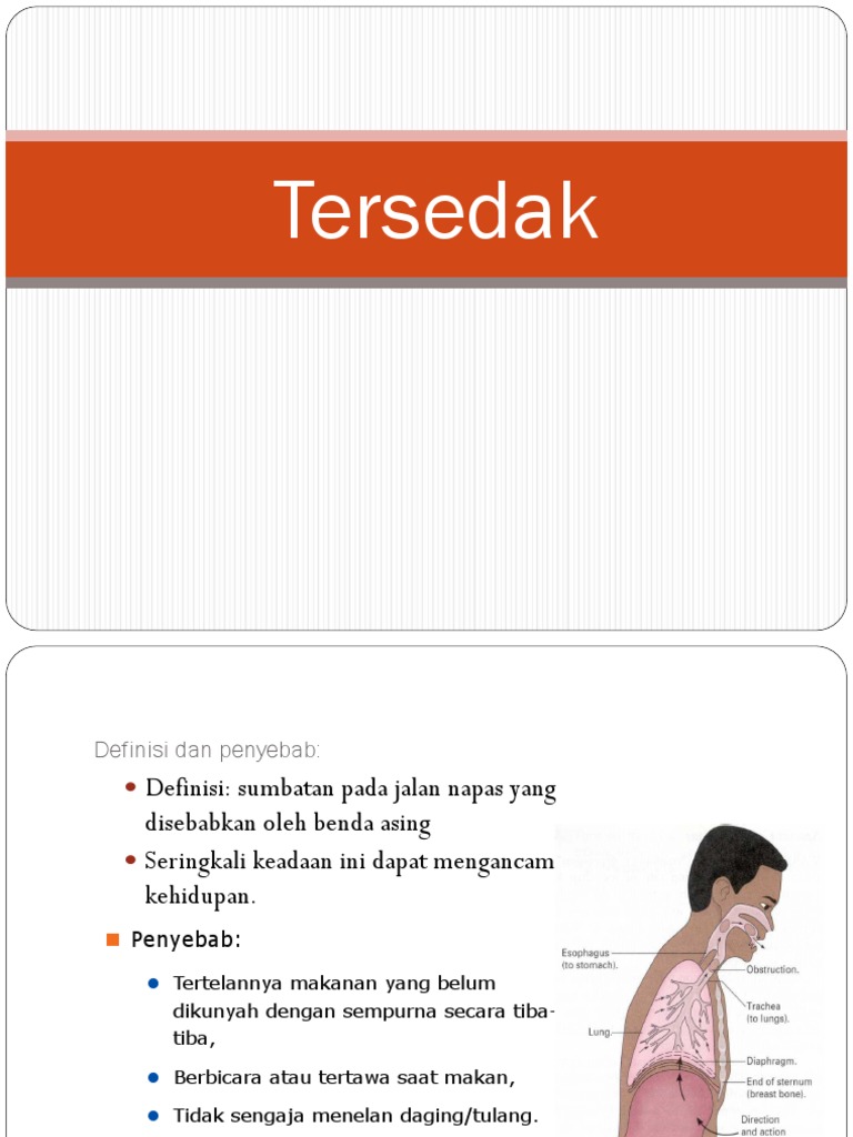 Penanganan Tersedak dan Teknik Pertolongan | PDF | Kesehatan Holistik