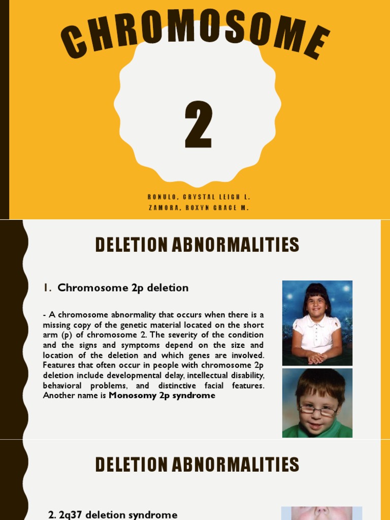 Chromosome 2 Abnormalities Overview | PDF