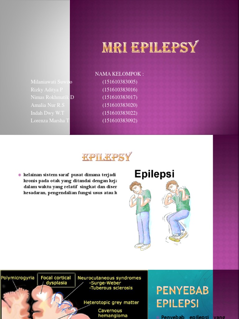 MRI Epilepsi | PDF