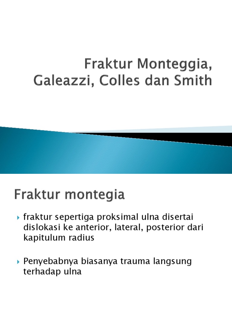 Fraktur Monteggia, Galeazzi, Colles Dan Smith | PDF