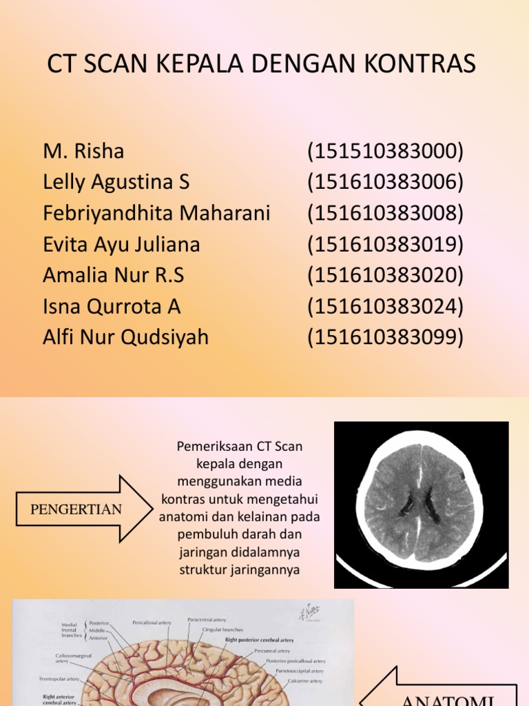 CT Scan Kepala Dengan Kontras Kel | PDF