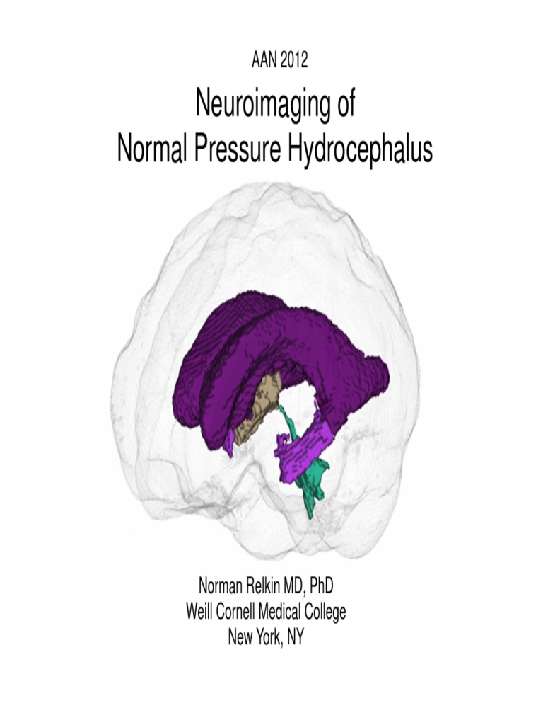 Neuroimaging of Normal Pressure Hydrocephalus | PDF | Cerebrospinal ...