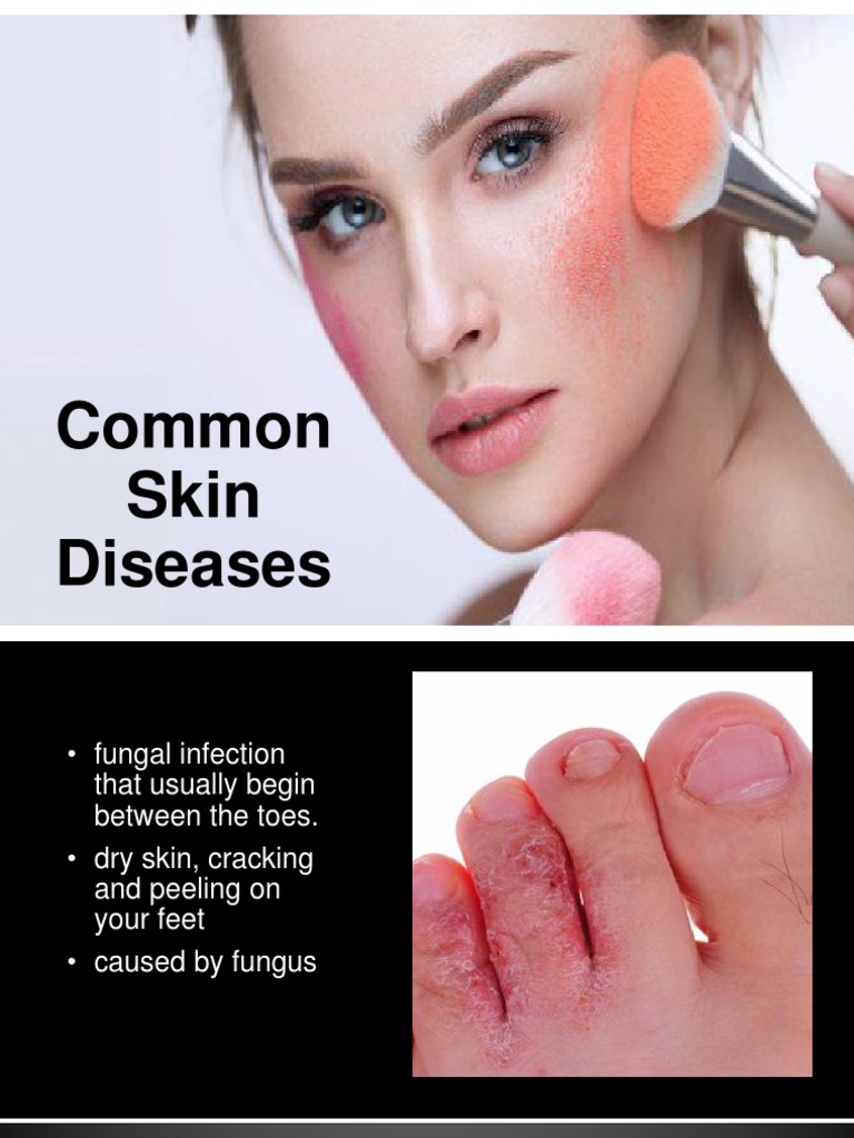 Common Skin Dis WPS Office | PDF | Skin | Cutaneous Conditions