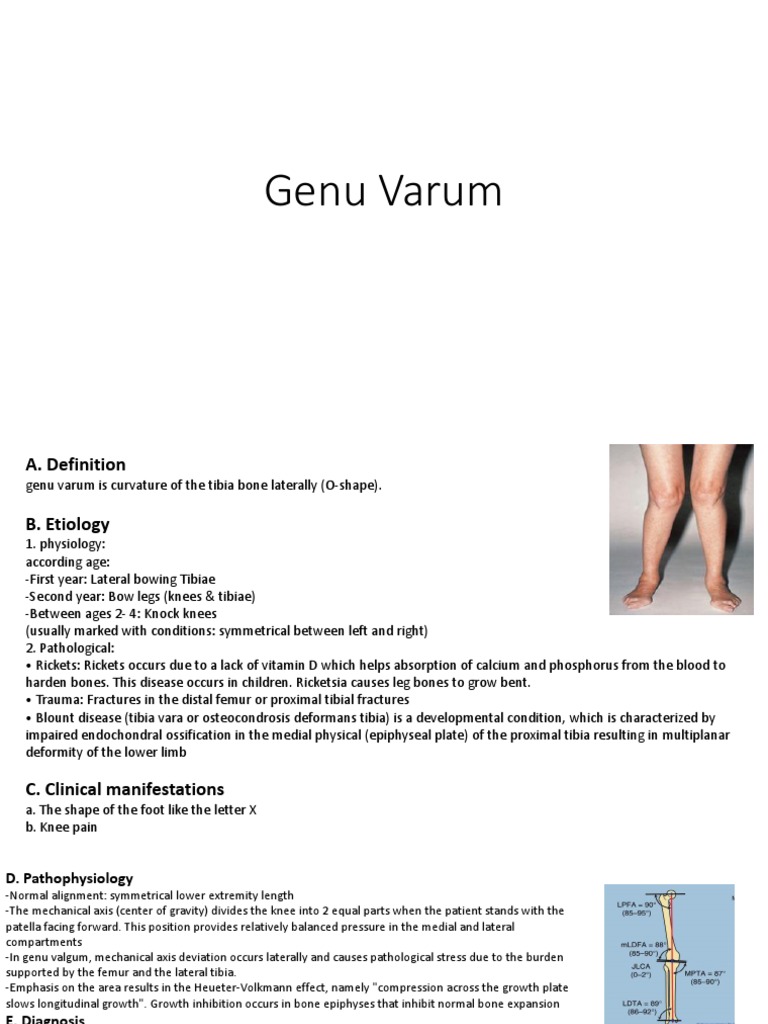 Genu Varum | PDF | Knee | Human Leg