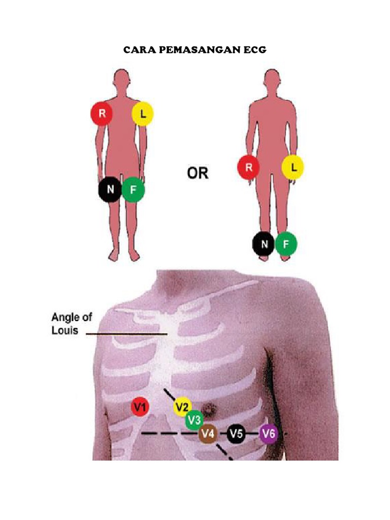 Cara Pemasangan Ecg | PDF