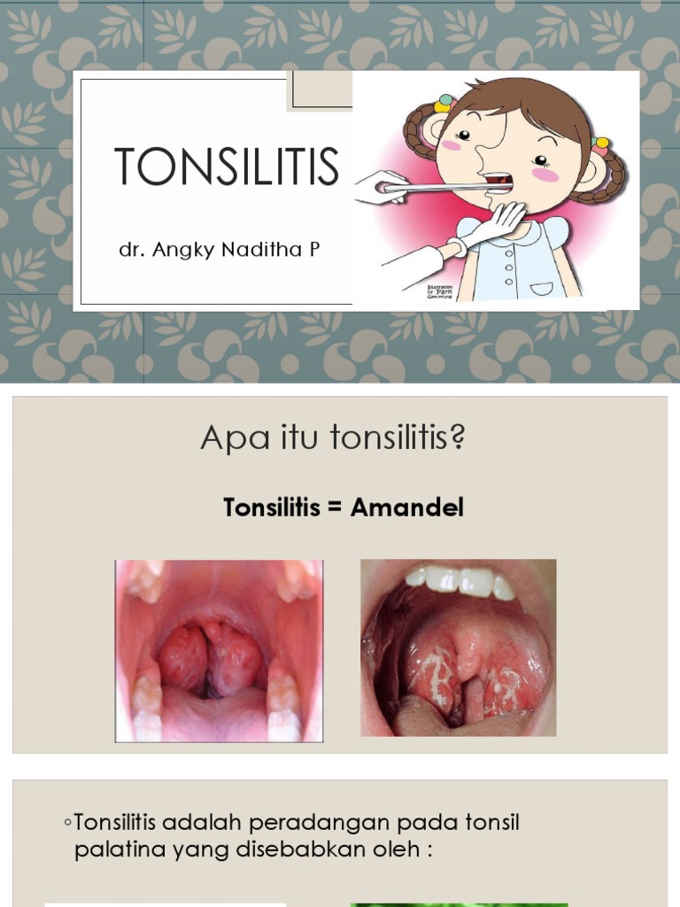 Tonsil | PDF