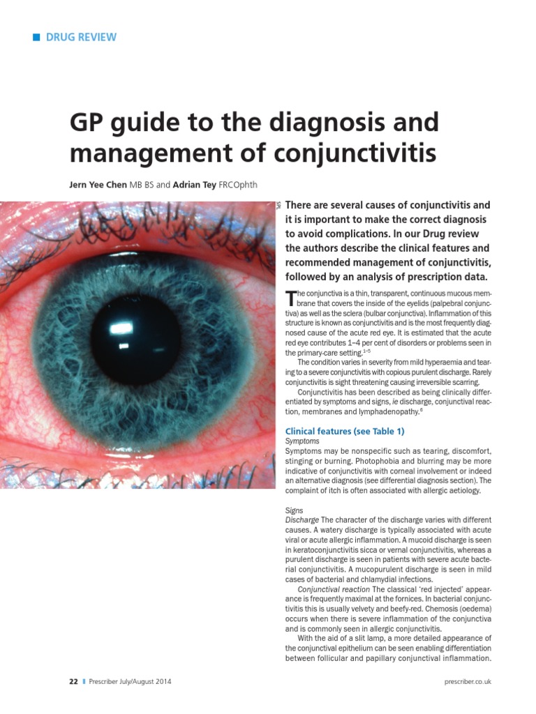 GP Guide To The Diagnosis and Management of Conjunctivitis: Drug Review ...