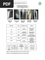 Niveles Axilares de Berg | PDF | Finanzas y administración del dinero