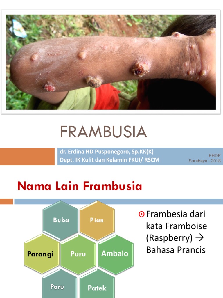 FRAMBUSIA | PDF