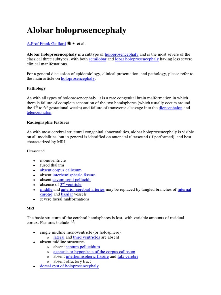 Alobar Holoprosencephaly Is A Subtype of | Download Free PDF | Cerebrum ...