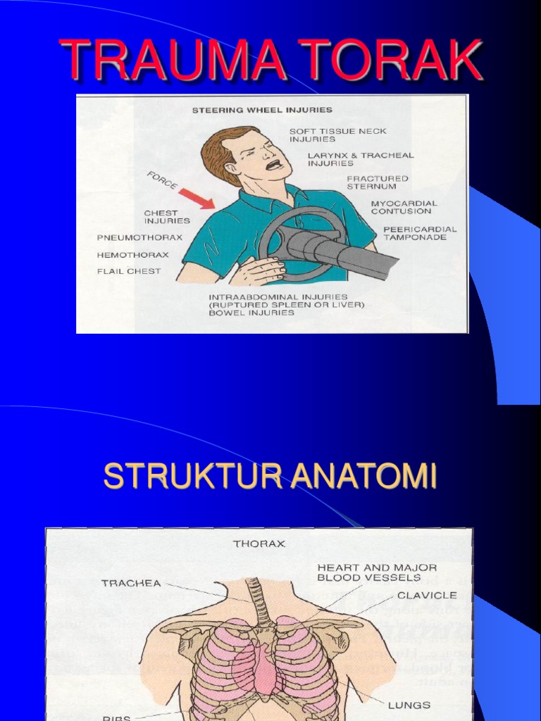 Trauma Thorax | PDF