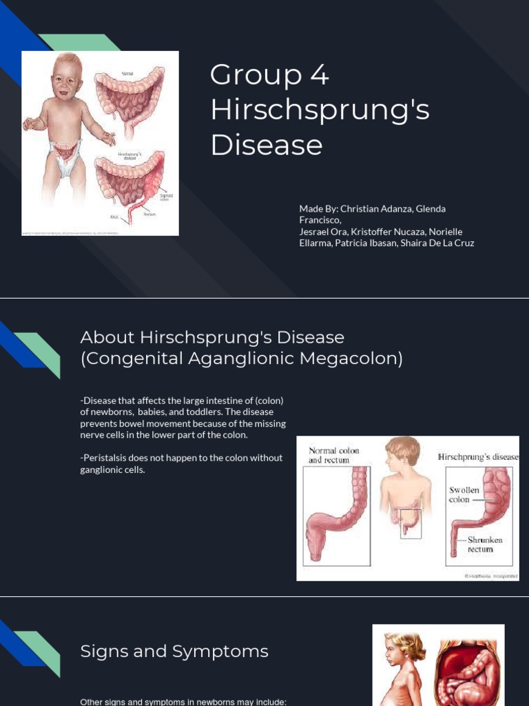 Hirschsprung's Disease | PDF