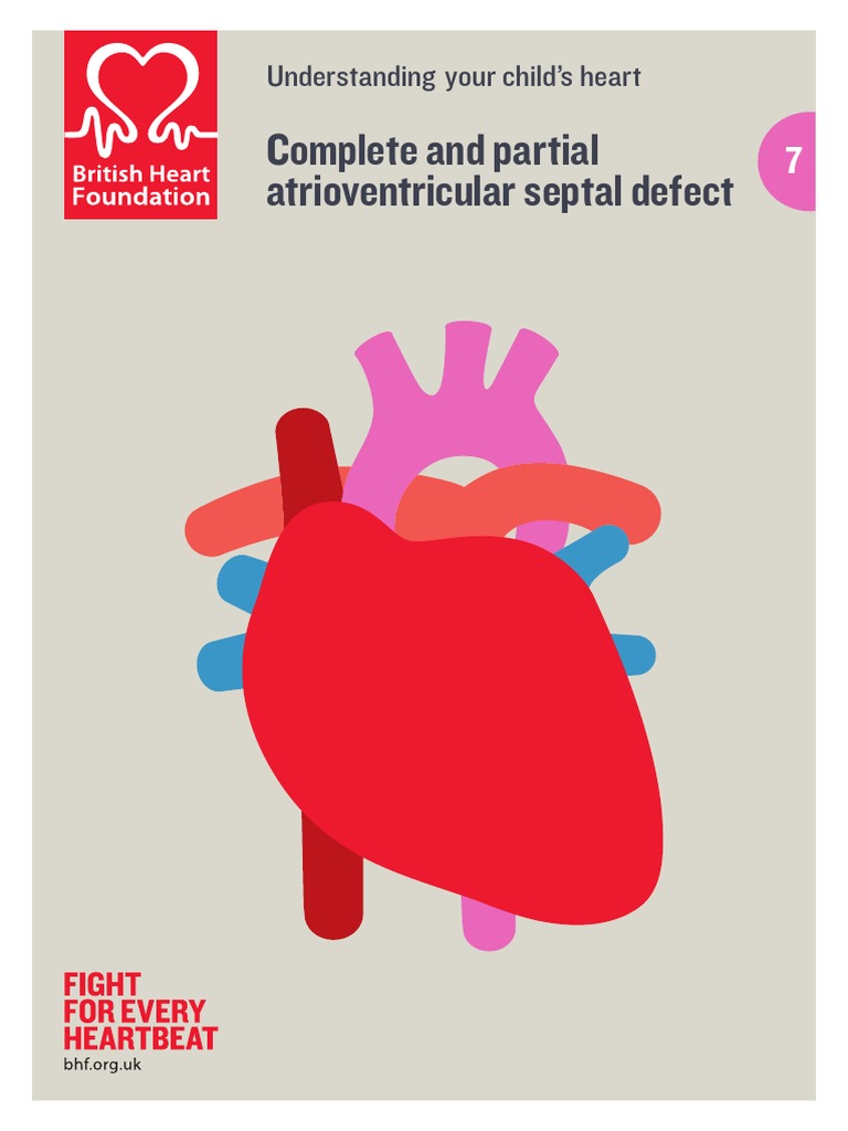Complete and Partial Atrioventricular Septal Defect: Understanding Your ...
