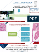 RCEOP Regimen Rituximab Cyclophosphamide Etoposide Vincristine ...