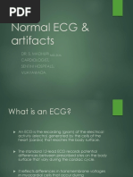 EKG Pocket Guide | PDF | Cardiac Electrophysiology | Electrocardiography