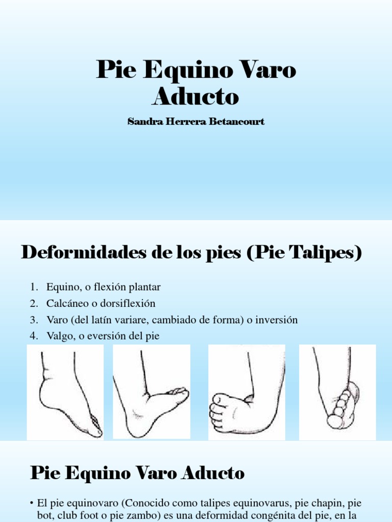 Clasificación y Tratamiento del Pie Equino Varo | PDF | Pie | Anatomía