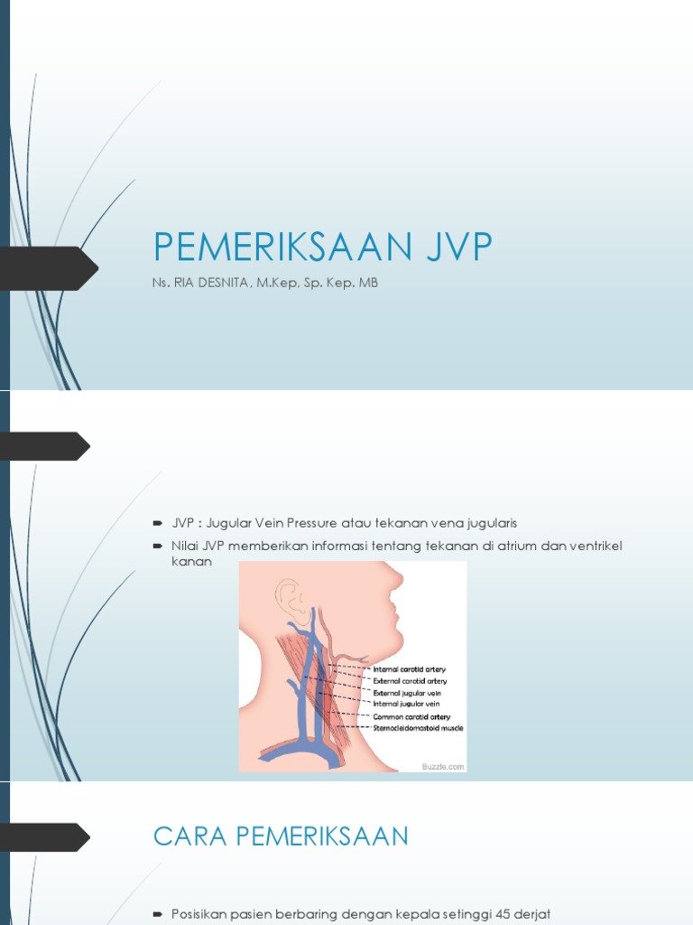 Assessing Jugular Vein Pressure: A Guide to Evaluating Right Atrial and ...