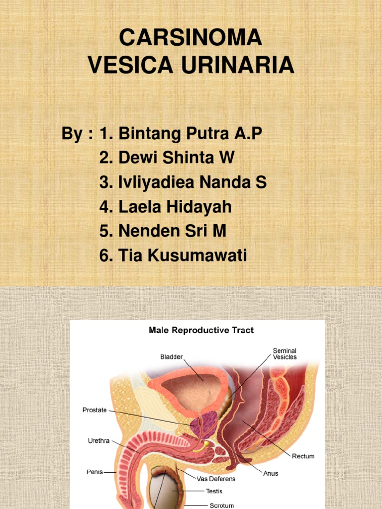 CA Vesika Urinaria | PDF
