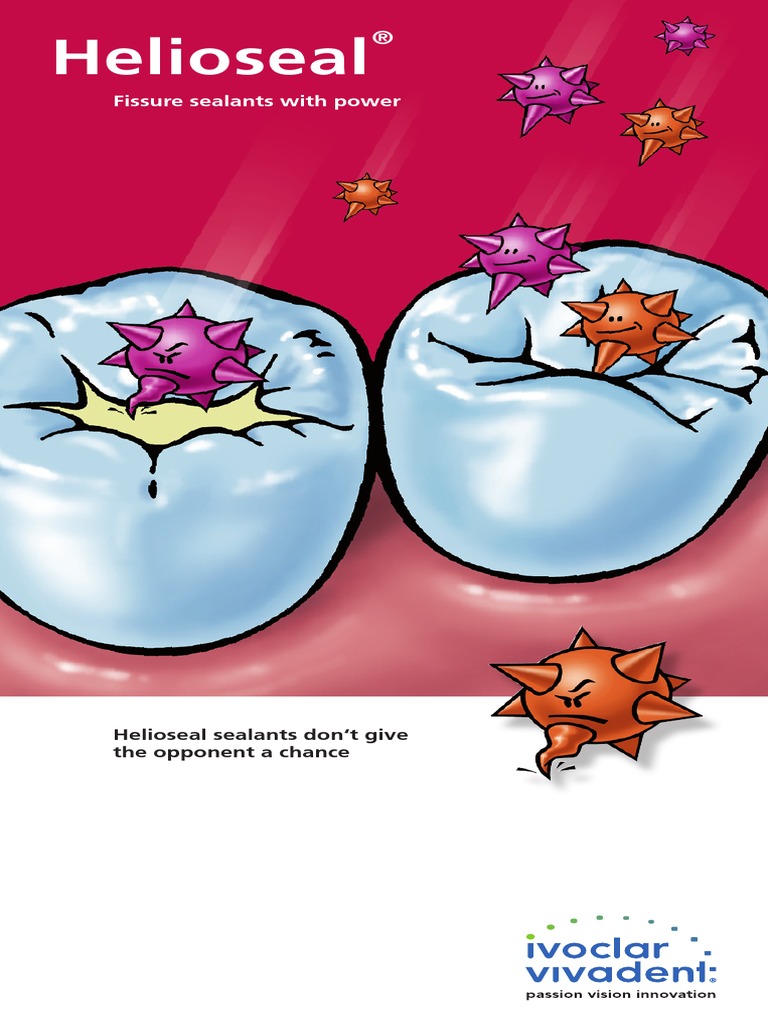 Helioseal: Fissure Sealants With Power | PDF | Dentistry | Mouth