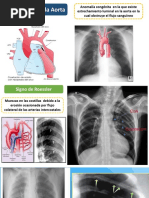Signo de Mapache | PDF | Lesión | Medicina