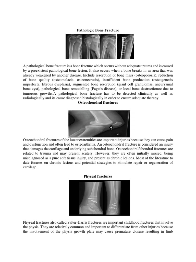 Pathologic Bone Fracture | PDF | Osteoblast | Bone